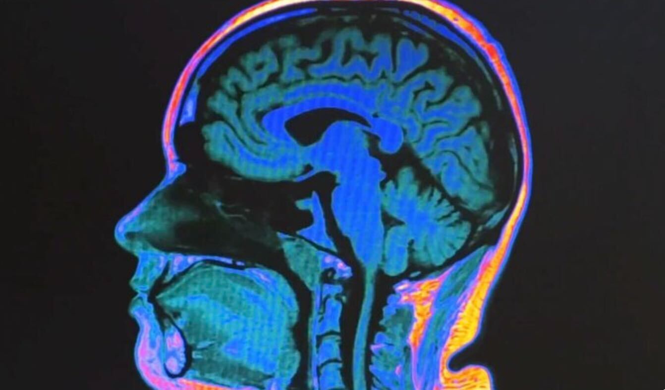 Neurix Focus & Energy™